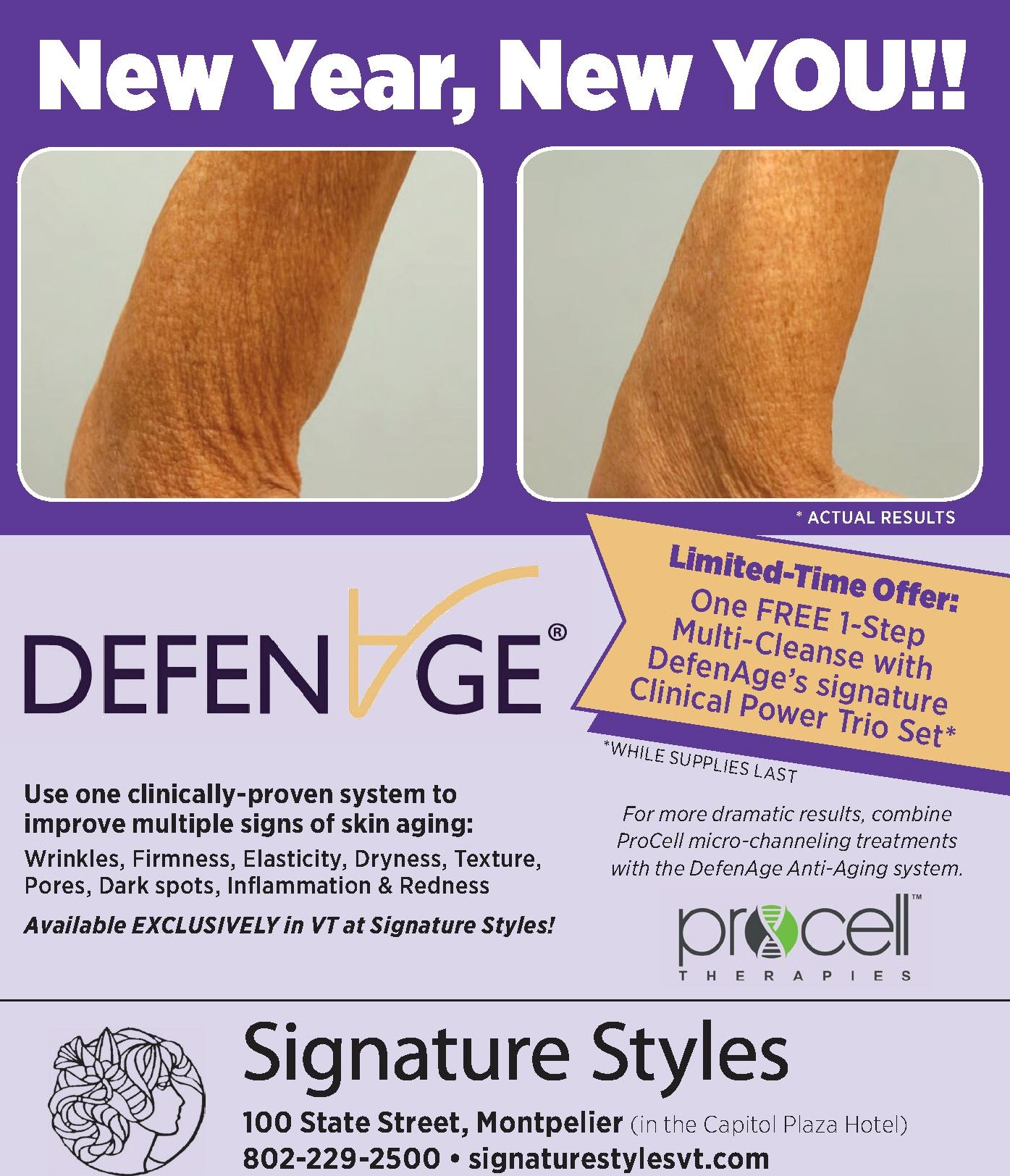 Signature Styles Now Offers ProCell Microchanneling and is Also the ...